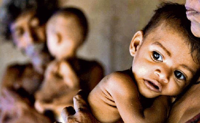 बार-बार जो होंगे दस्त, बच्चा होगा कुपोषण ग्रस्त - The Ample News